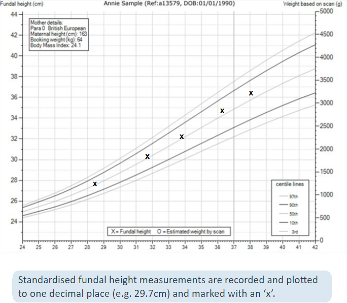 1.11 Plotting fundal height – E-Learning India